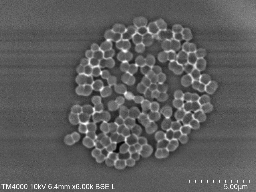 Sciency Thoughts: Acidaminococcus provencensis: A new species of ...