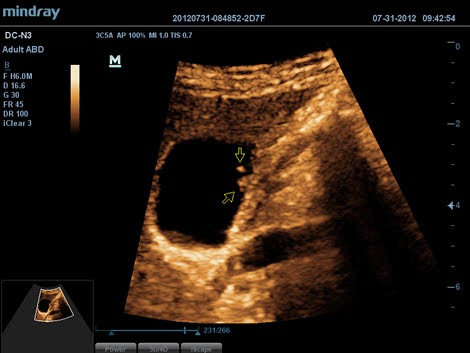 USG 4 Dimensi DC-N3 PRO Mindray, USG 4D Terbaik dan Tercanggih ...