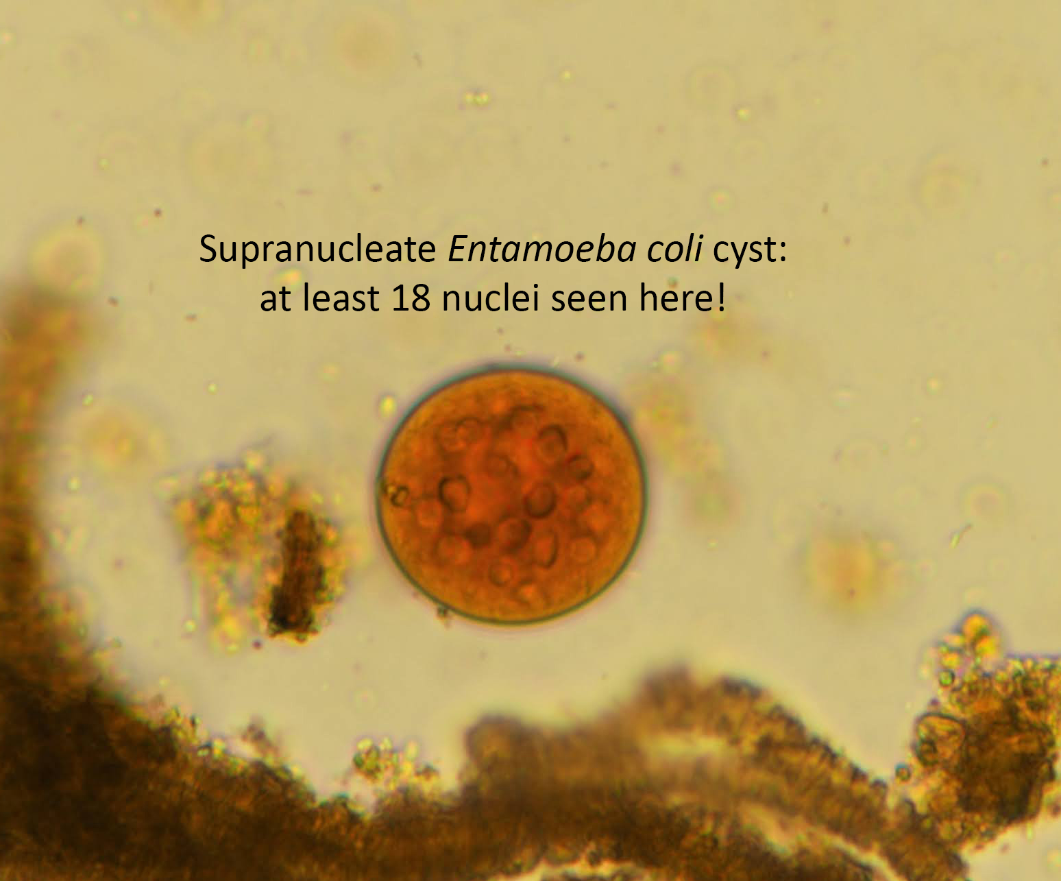 Entamoeba Coli Labeled
