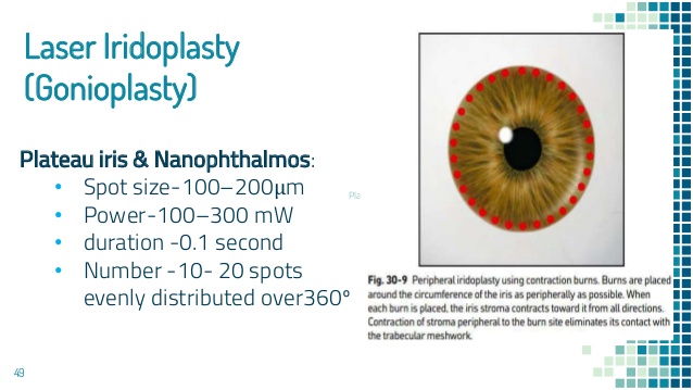 GLAUCOMA SPECIALIST BLOG: "THE GLOG"