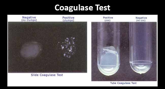 Merlins Micro World: Staphylococcus aureus - Laboratory diagnosis and ...