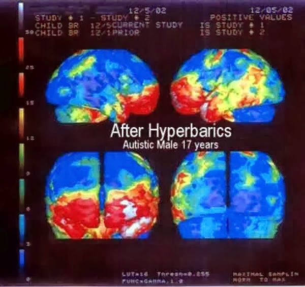 Didattica e Cervello: Educazione emotiva e gestione delle emozioni ...