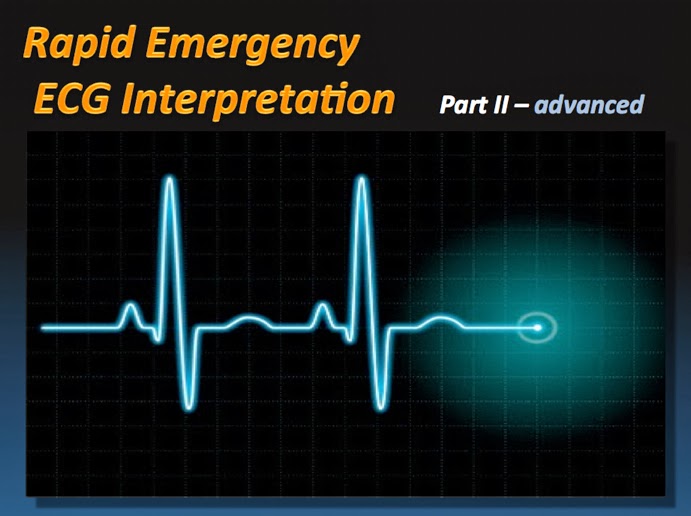 the PA Corner: Rapid ECG Interpretation: Part II