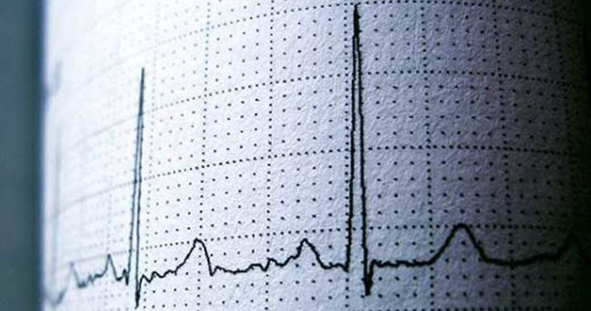 Right Ventricular Conduction Delay Meaning, Symptoms, Causes, Treatment ...