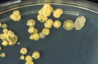 View From The Petri Dish: Rapid Detection of Cronobacter spp.