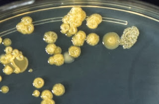 View From The Petri Dish: Rapid Detection of Cronobacter spp.