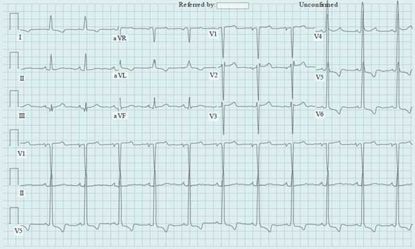 Cardiac Risk Assessment Prior to Noncardiac Surgery Case File