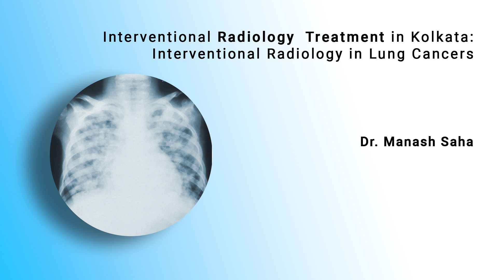 Interventional Radiology Treatment In Kolkata: Interventional Radiology ...
