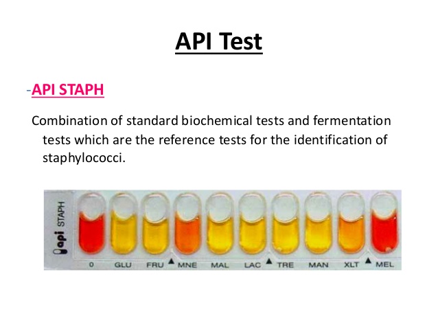 Merlins Micro World: Staphylococcus aureus - Laboratory diagnosis and ...