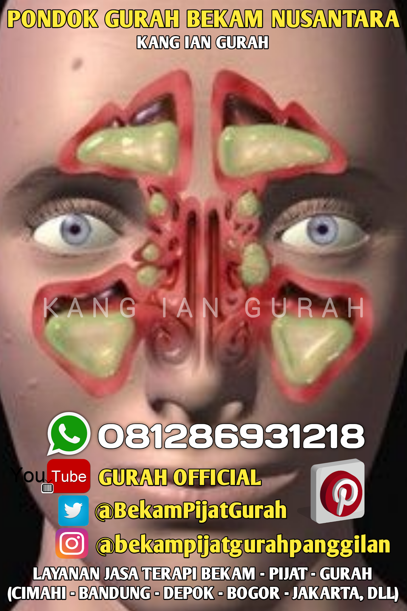 Gallery Kegiatan Proses Terapi Bekam Gurah dan Pijat