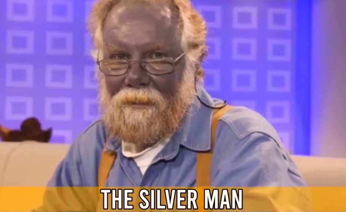 10 Most Unique And Unusual People in the World Rare Humans That Are one ...