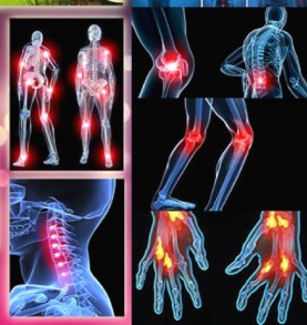 SOLUSI MASALAH PERSENDIAN: Sering sakit sendi