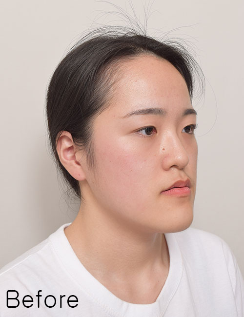 How can I improve long face?