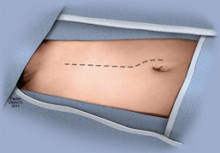 South Surgery Ward Test Guide