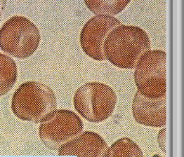"Hematología en acción": SERIE ROJA NORMAL Y PATOLÓGICA