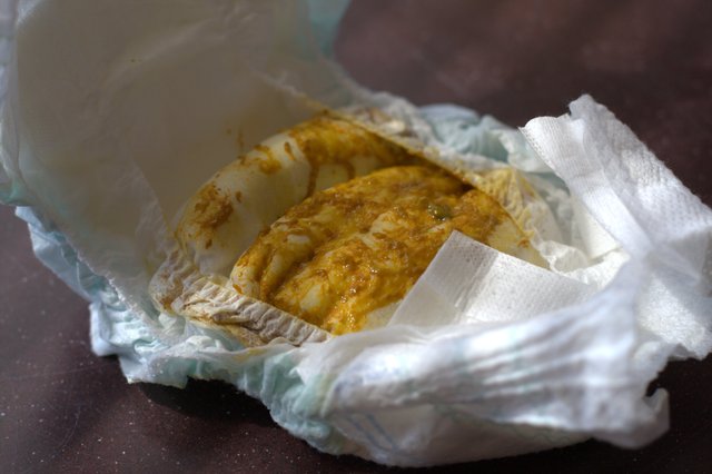 Signs of Milk Transfer