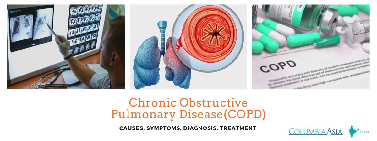 Chronic Obstructive Pulmonary Disease (COPD)