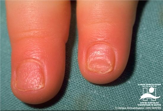 CLINICA INTEGRAL GRUPO DRA MIRANDA 2012: anemia seminario 10