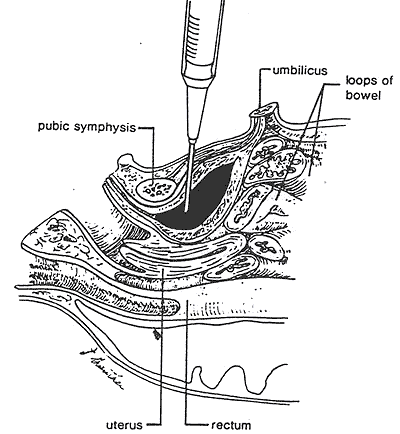 Advanced Maneuvers: On Tap