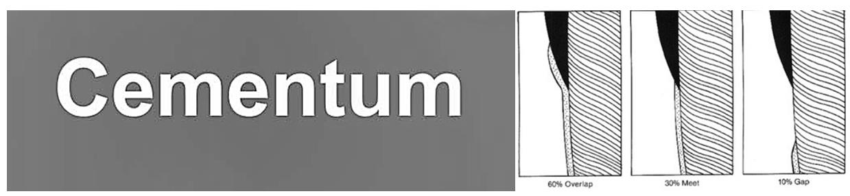 cementum structure (2) l Oral histology & biology MCQs for dental ...