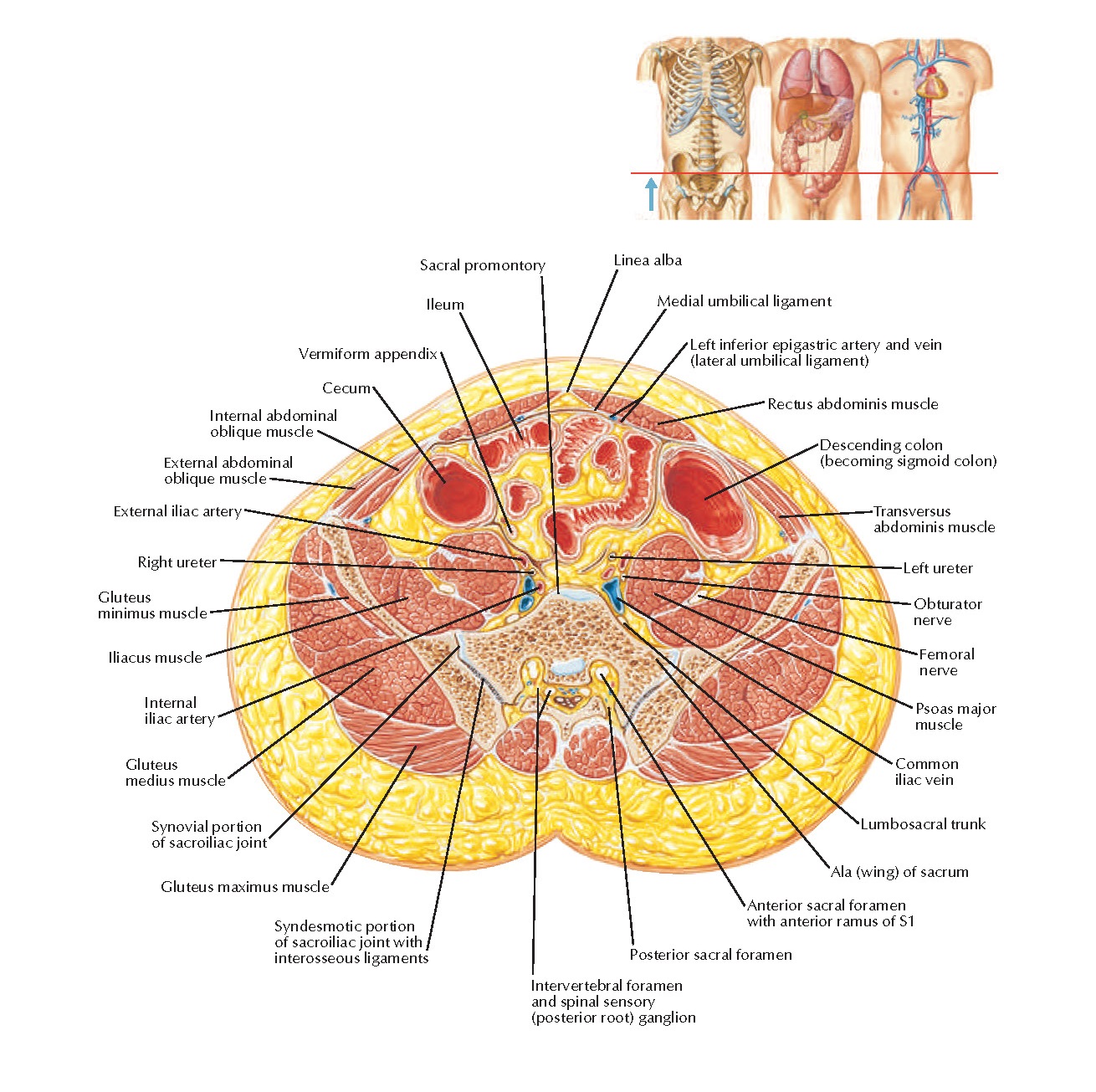 Transverse Section of Abdomen Level of S1 Anterior Superior Iliac Spine ...