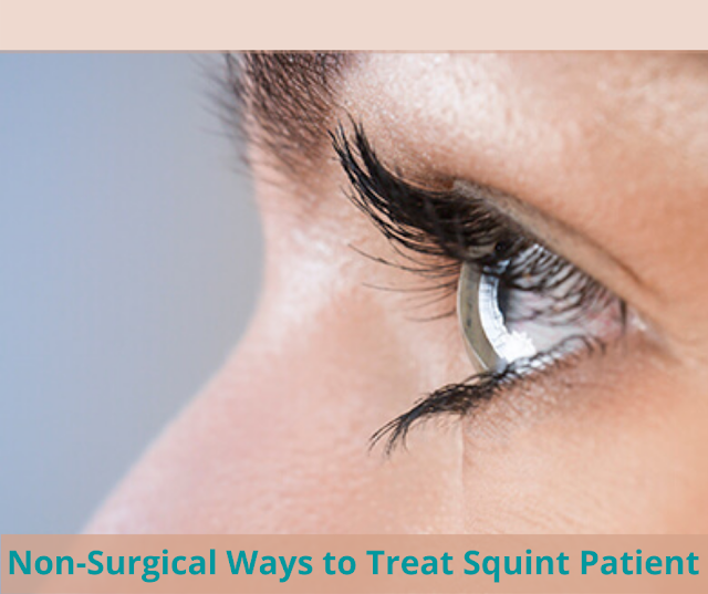 Non-Surgical Ways to Treat Squint Patient