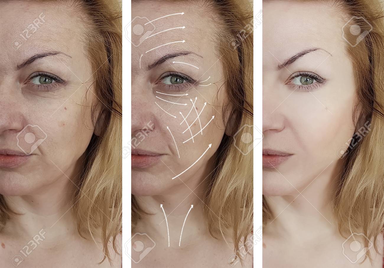 TÁC DỤNG LÀM ĐẸP TUYỆT VỜI CỦA RETINOL. CÁCH SỬ DỤNG RETINOL CHO NGƯỜI ...