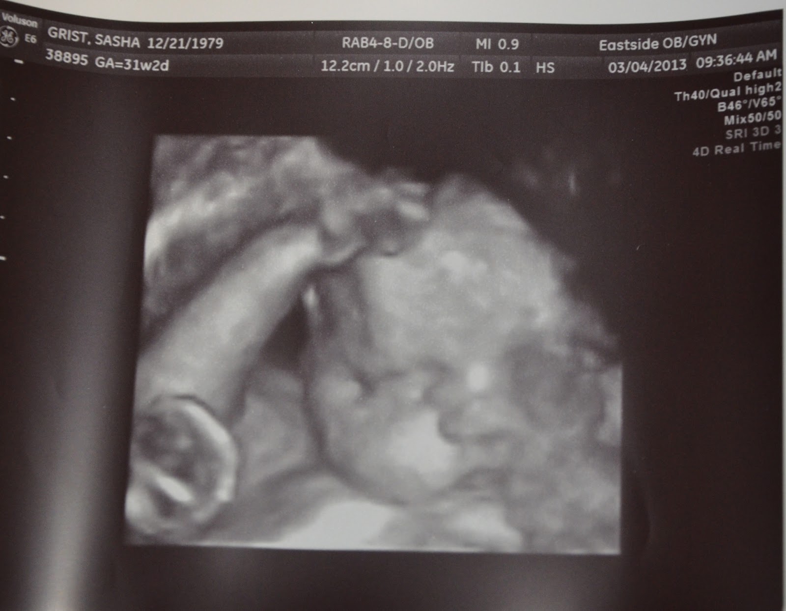 And Then There Were Five!: 31 Weeks Ultrasound