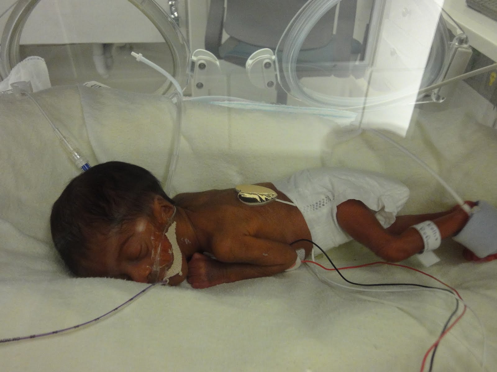 Kenadie Camille: Kenadie's Story