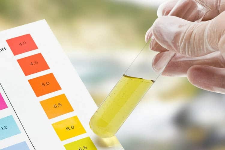 Selena Maribel Granja Carrera A4: Análisis químico de la orina. Ph urinario