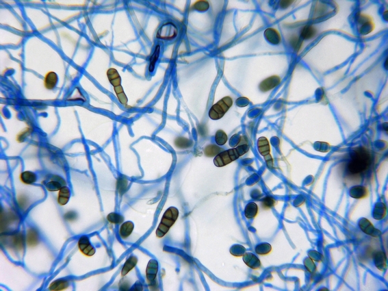 Fun With Microbiology (What's Buggin' You?): Pithomyces species