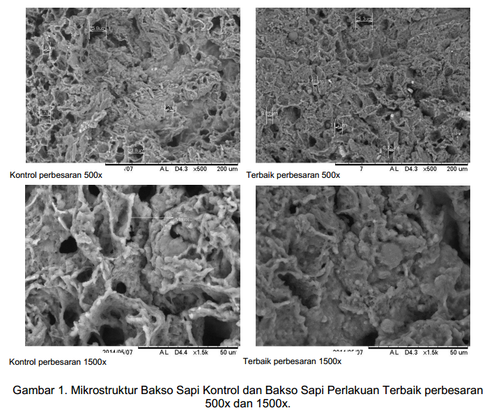 Health and Nutrition Corner: Scanning Electron Microscope (SEM)