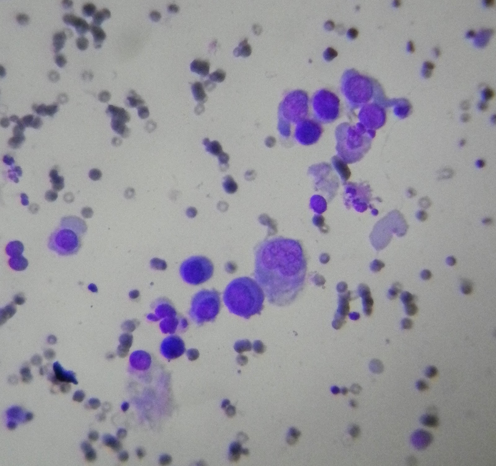 into the roots: Lung cytology