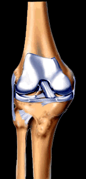 ARTROSCOPIA RODILLA - ARTROSCOPIA DE HOMBRO - PERU: RODILLA