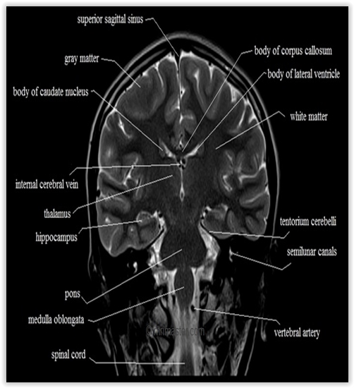 Michael's MRI Study Page: PROCEDURES I (MRI 104)