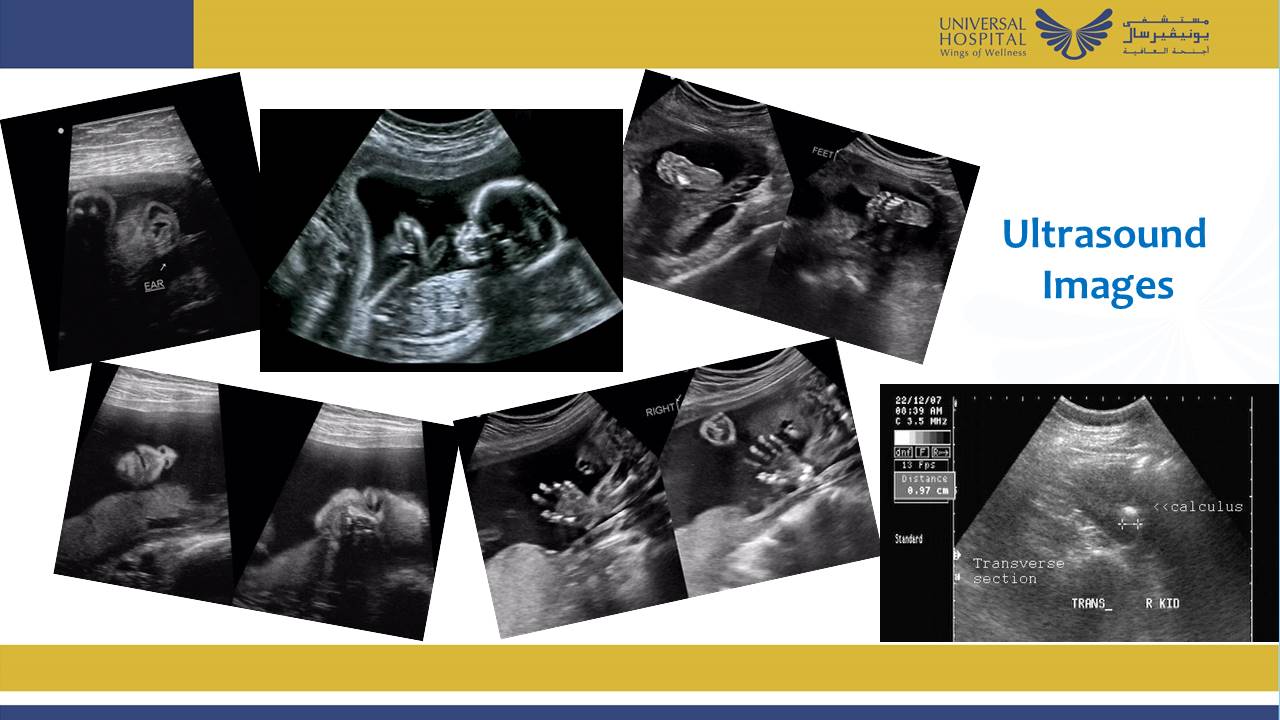 Ultrasound Scans (The FAQs) - Dr. Imran Ahmad Khan - HOD - Department ...