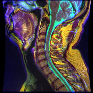 Nevit's blog: Color MRI of the Cervical Spine