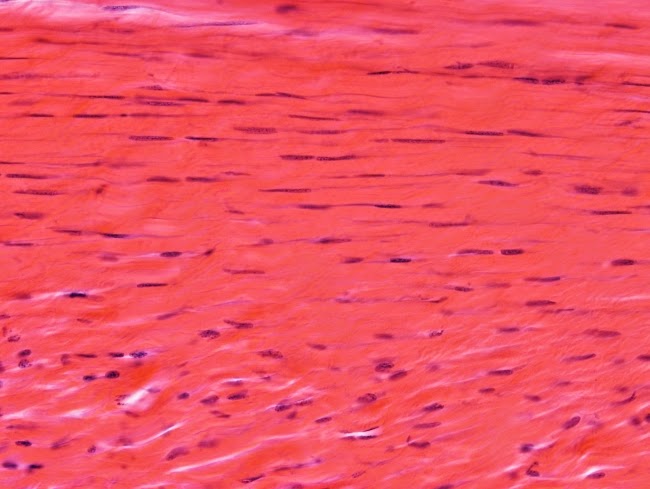 Andrea: TEIXITS CONNECTIUS