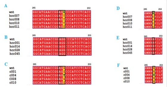 Codon 249 P53 Gene Mutation Among Hepatocellular Carcinoma Patients In ...