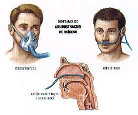 tipos de aislamientos: Oxigenoterapia