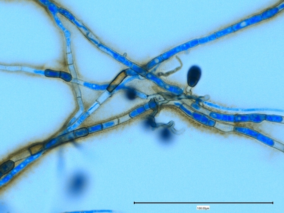 Fun With Microbiology (What's Buggin' You?): Pithomyces species