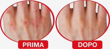 Bellezza e Benessere: Mani screpolate: colpa dei detersivi e non solo