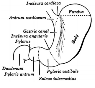 Congenital Hypertrophic Pyloric Stenosis