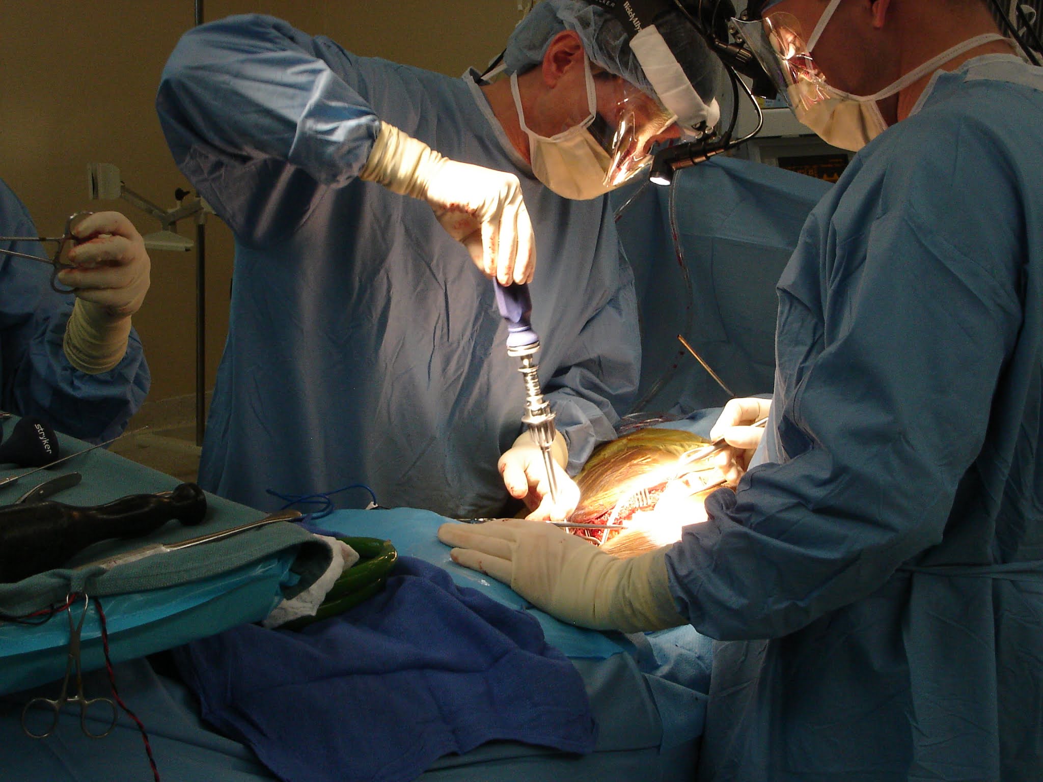 Vertebral Column Resection (VCR) in Pediatric Spinal Deformity Part 2 ...