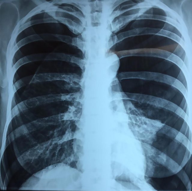 EMS SOLUTIONS INTERNATIONAL by @DrRamonReyesMD marca registrada: TRAUMA ...