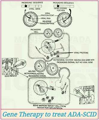 Gene Therapy and Its types