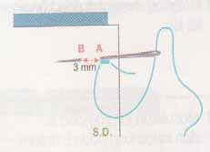 Skor A+ RBT: JENIS JAHITAN