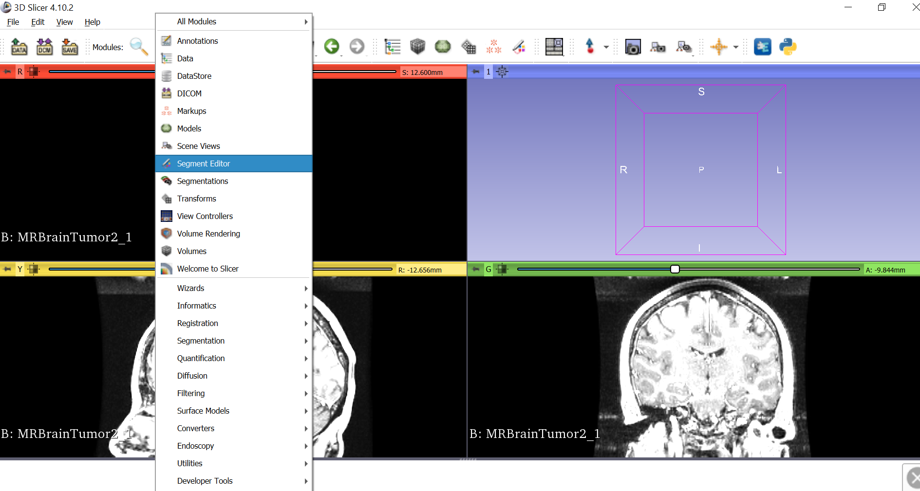 Everything Modelling and Simulation: Medical Image Segmentation with 3D ...