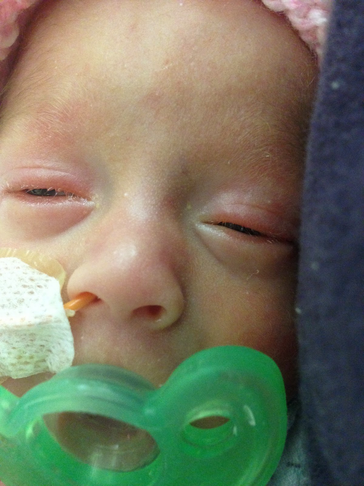 Kogan Twins: Eye Exams