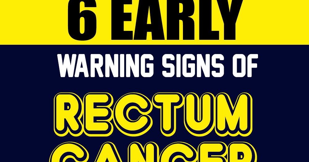 6 Unusual Signs Of Anal Cancer You Shouldnt Ignore